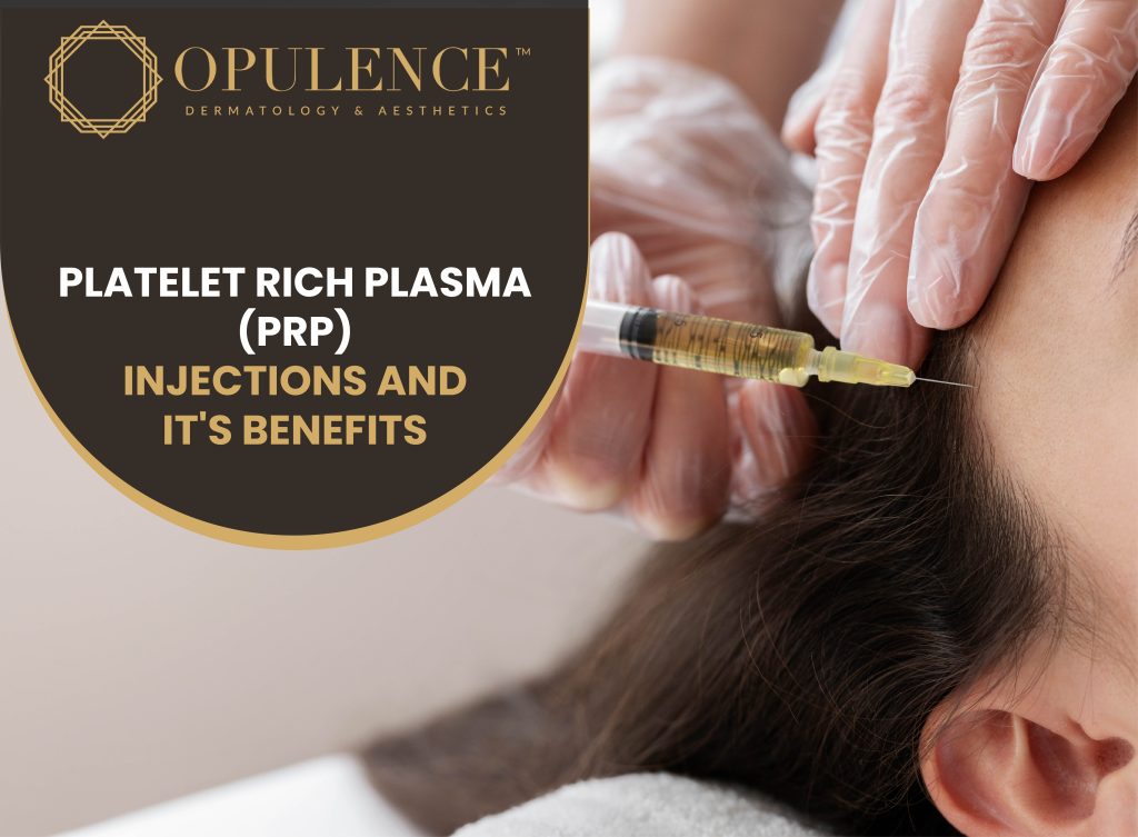 Platelet Rich Plasma (PRP) Injections and their Benefits - Opulence ...