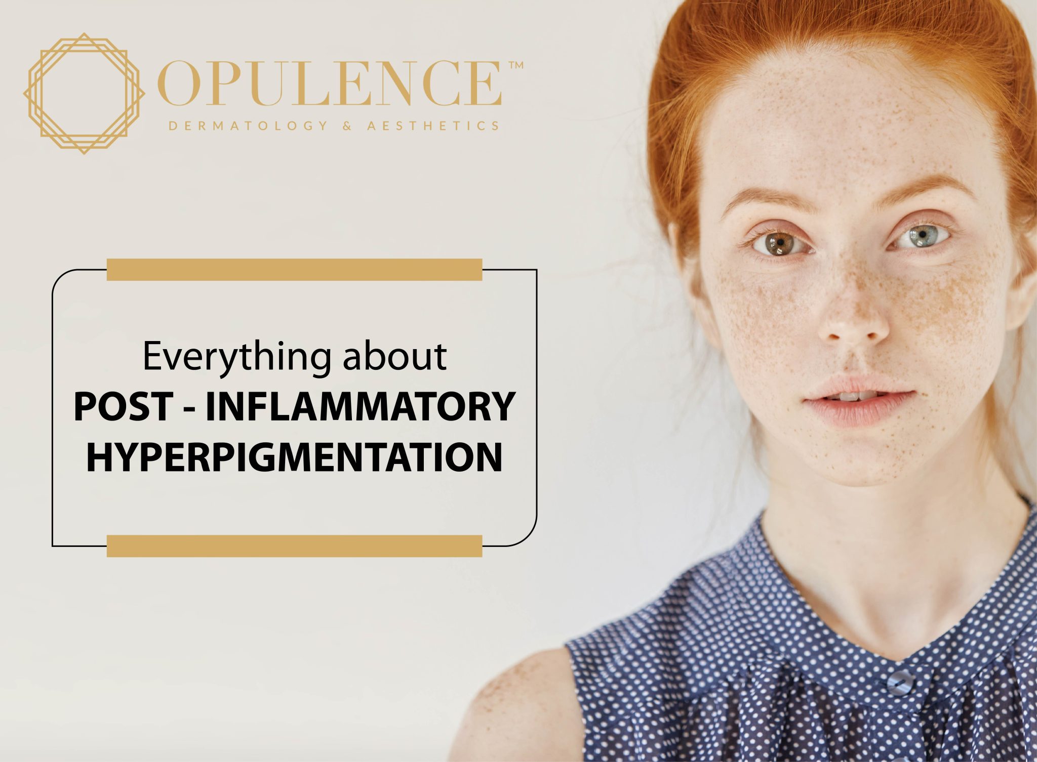 EVERYTHING ABOUT POST-INFLAMMATORY HYPERPIGMENTATION - Opulence ...